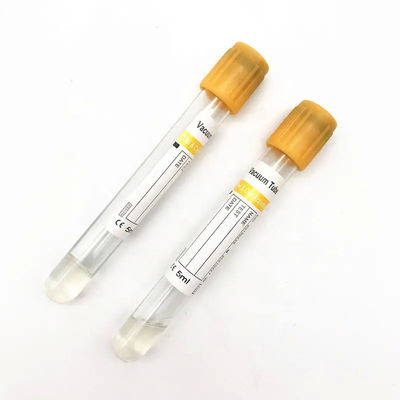 Quality Blood Test Materials & SST Blood Test Tube factory from China